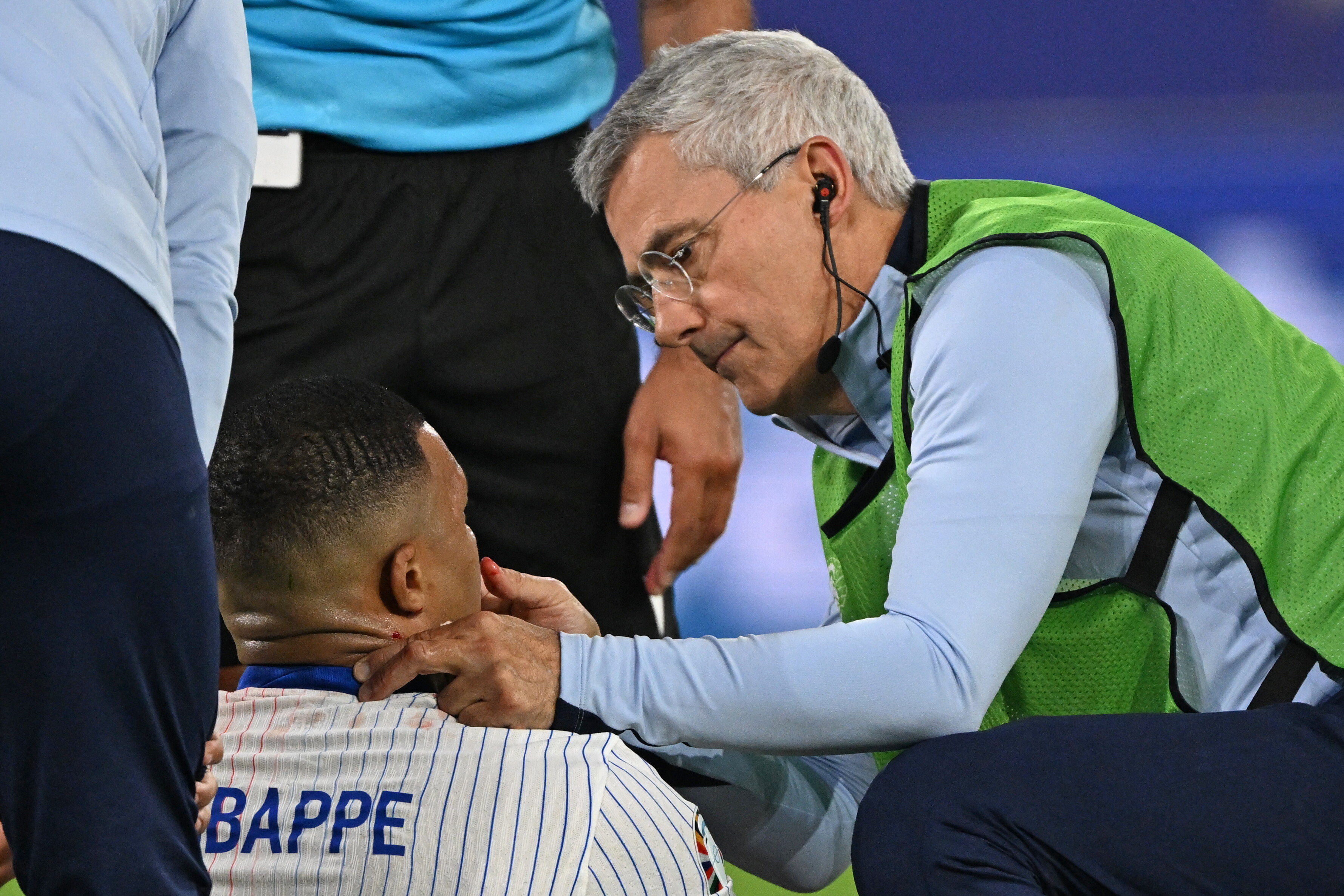 Francia, Mbappé va ko: pauroso scontro con Danso. Naso rotto?