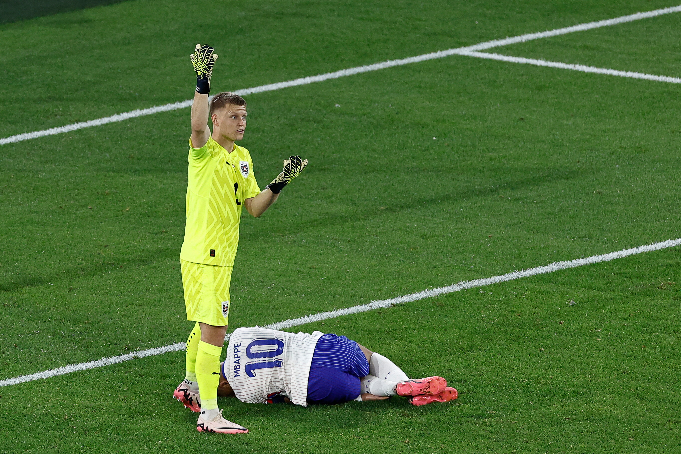 Francia, Mbappé va ko: pauroso scontro con Danso. Naso rotto?