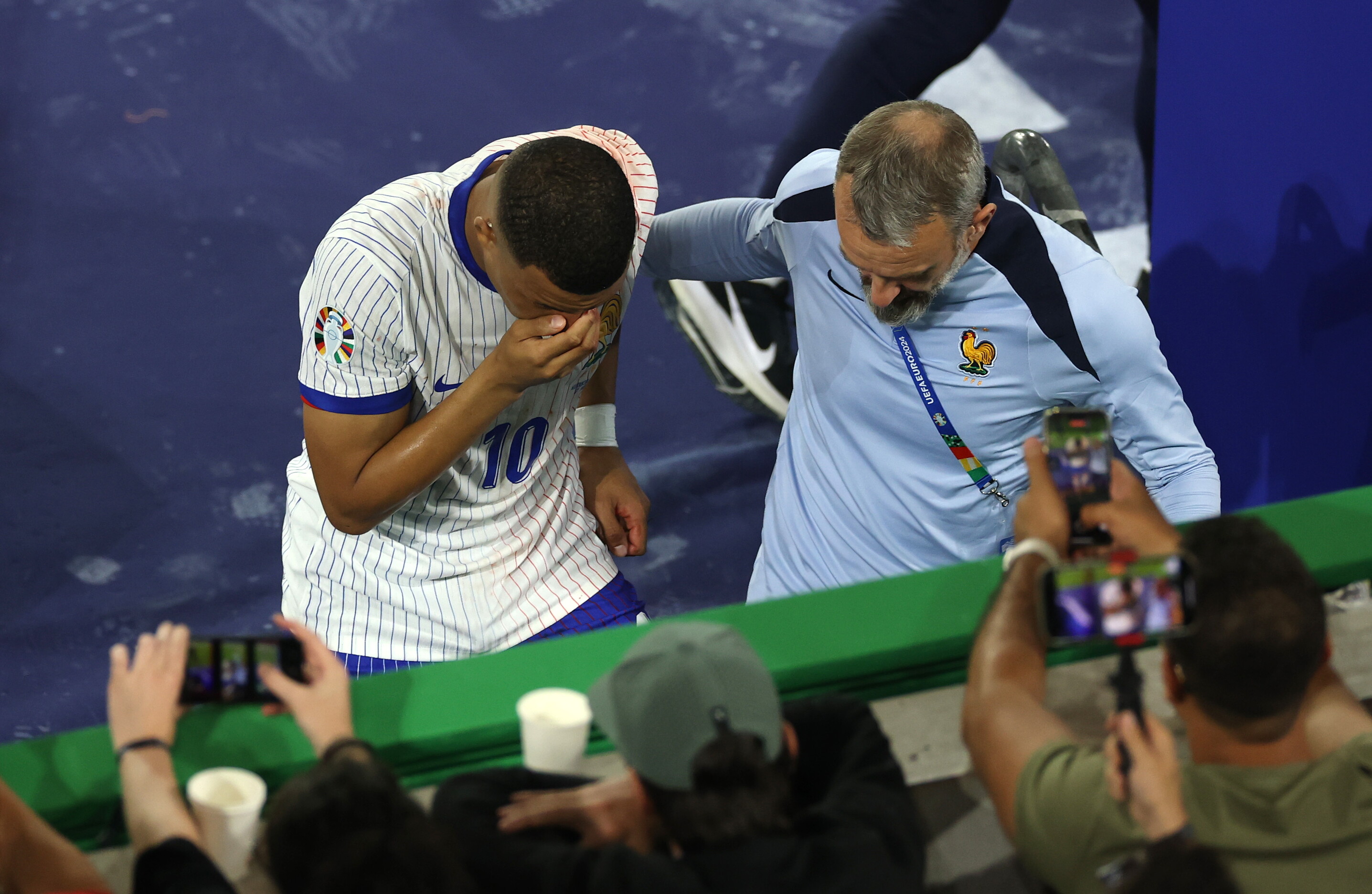 Francia, Mbappé va ko: pauroso scontro con Danso. Naso rotto?